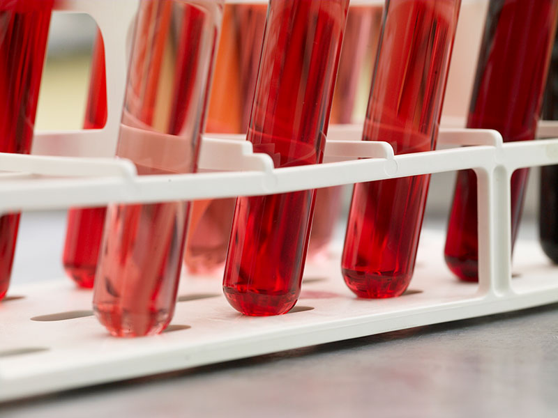 Why Do AnthocyaninsChange Color - Givaudan Sense Colour